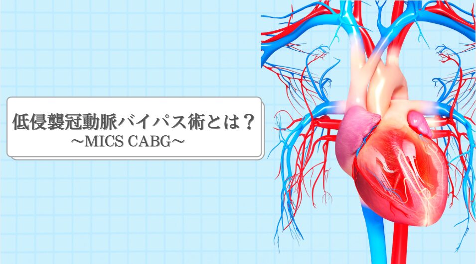 低侵襲冠動脈バイパス術（MICS CABG）とは？ ～身体への負担が少ない小さな傷で行う新しい冠動脈バイパス手術～ | 東京Dタワーホスピタル ...